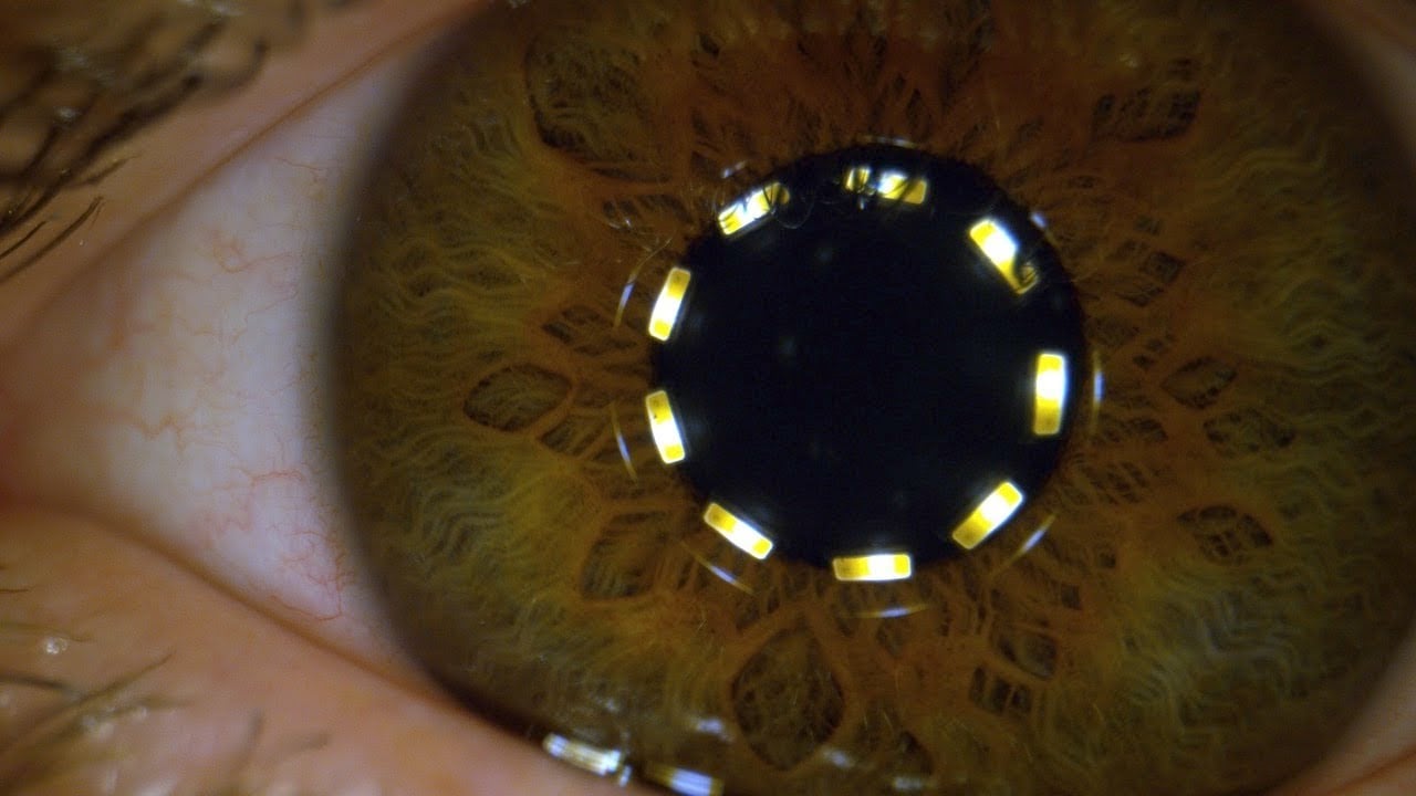 See How a Pupil Reacts to Light in Slow-mo Macro