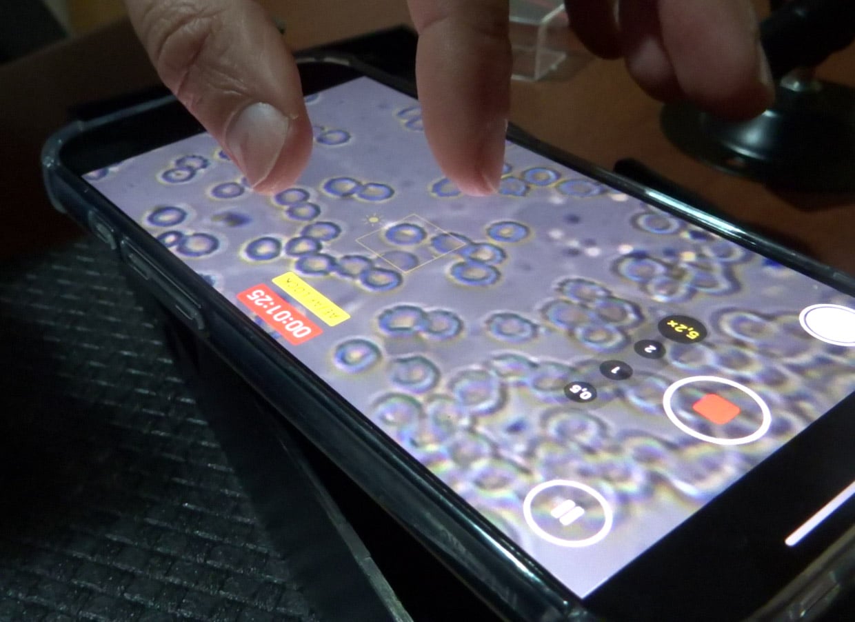 The DIPLE2 Turns Smartphones Into a Powerful Microscope
